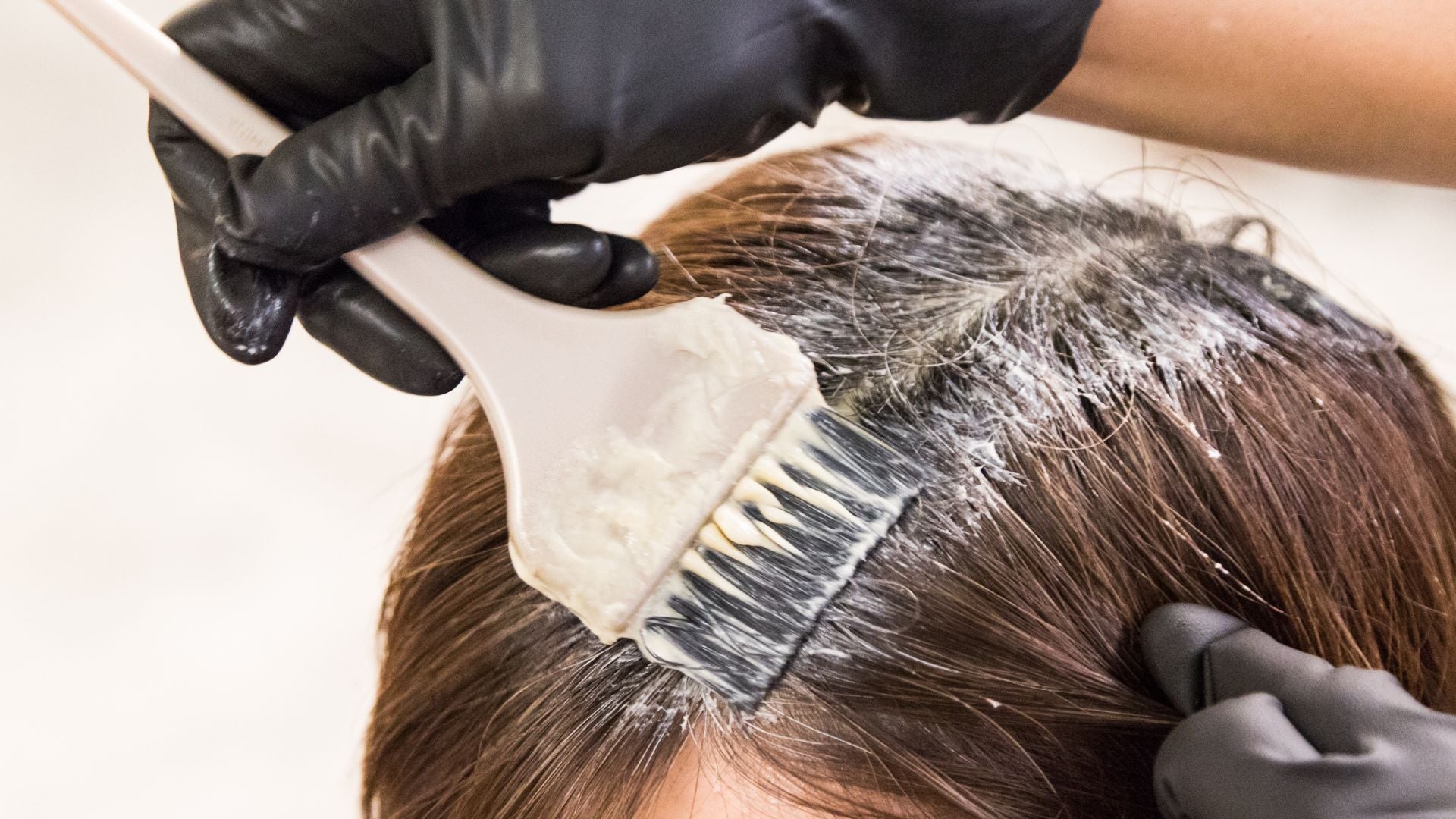 PPD Hair Dye Allergy Case Study: Avoidance Plan and Safe Alternatives ...